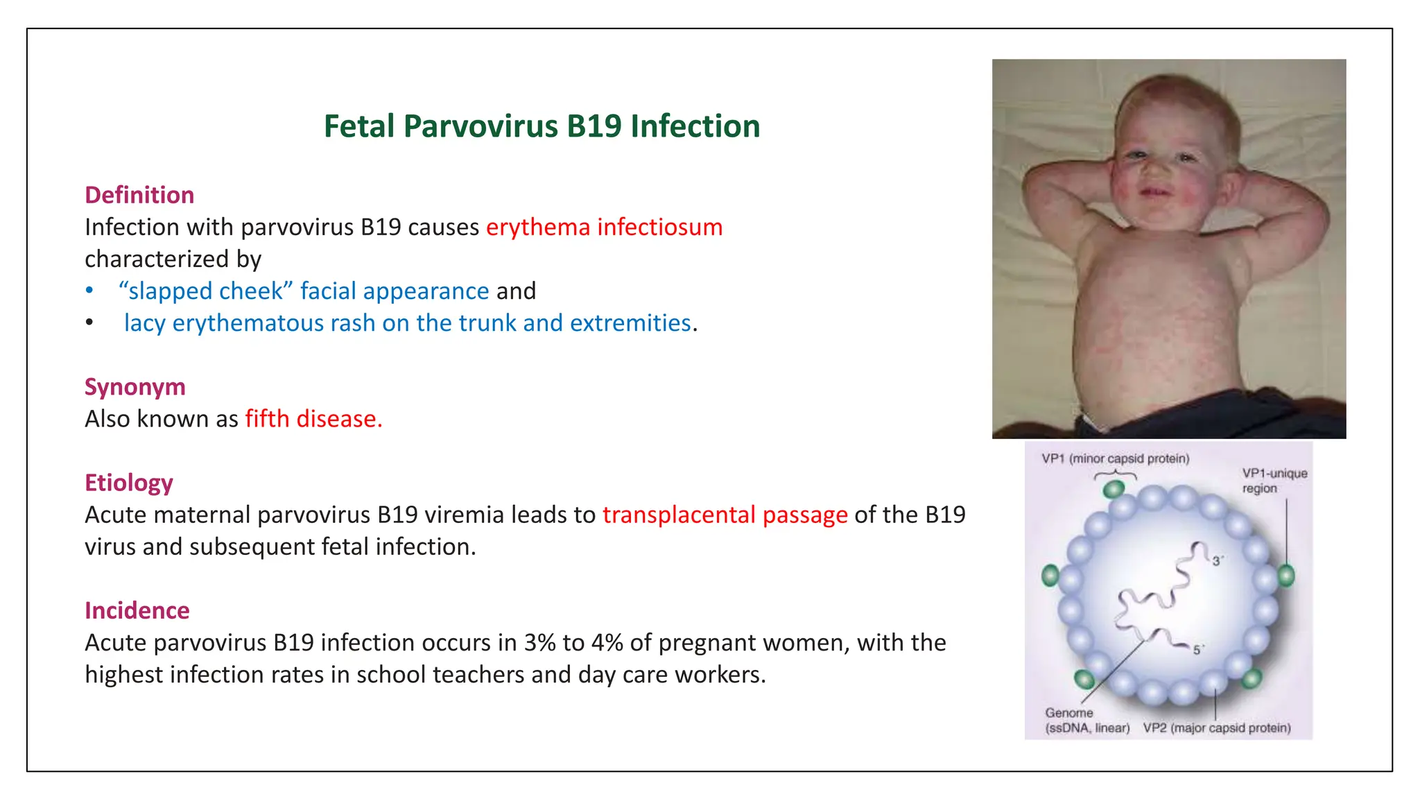 Ultrasound Features of Fetal Syndromes Part 1.pptx