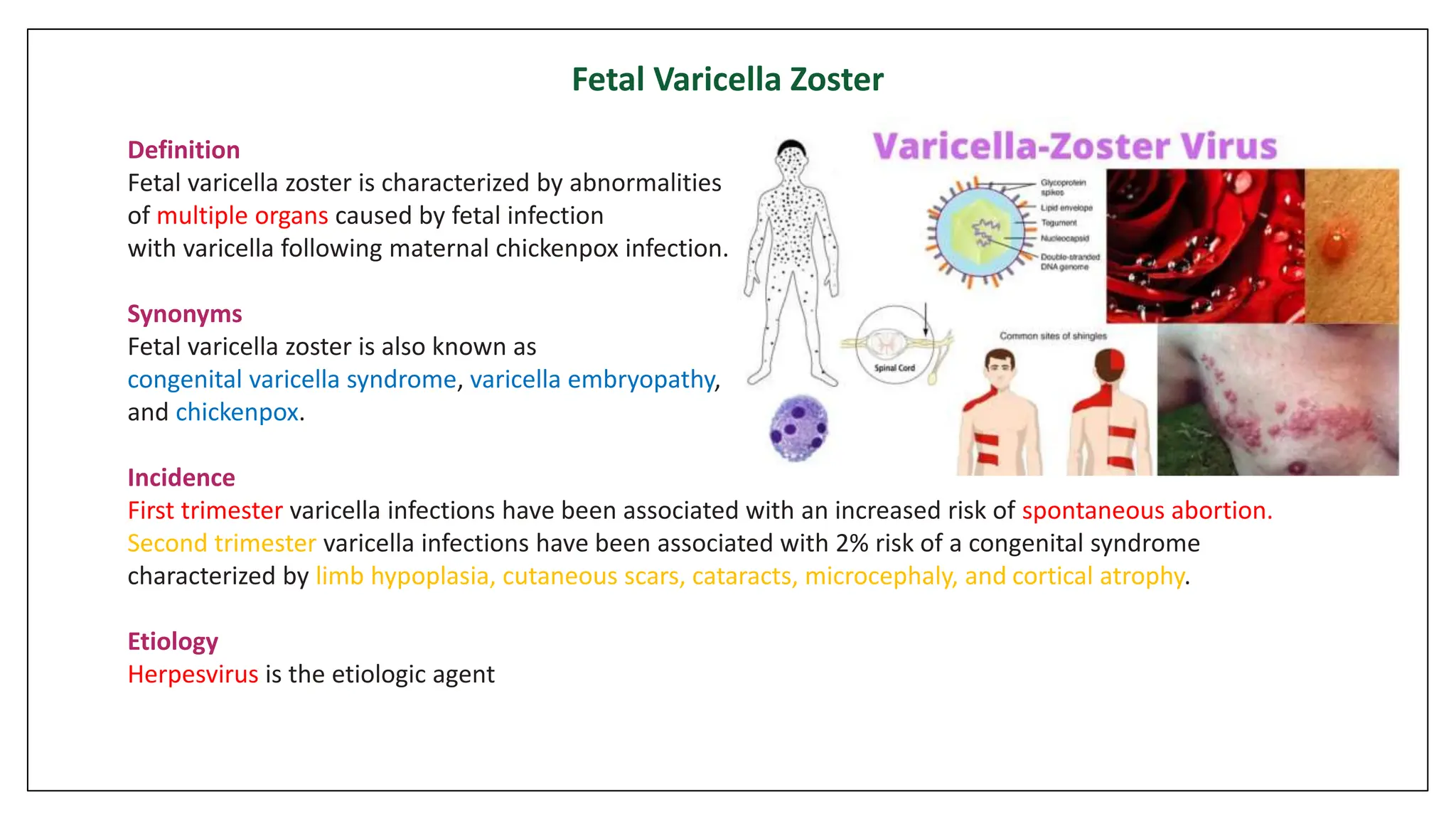 Ultrasound Features of Fetal Syndromes Part 1.pptx