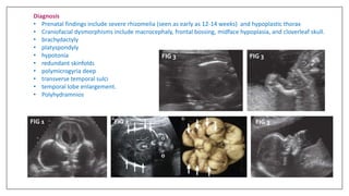 Ultrasound Features of Fetal Syndromes Part 1.pptx