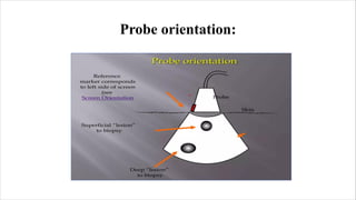 Ultrasound Guided Biopsy ppt . ANKITA KUMARIpdf | PDF