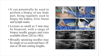 Ultrasound Guided Biopsy ppt . ANKITA KUMARIpdf | PDF