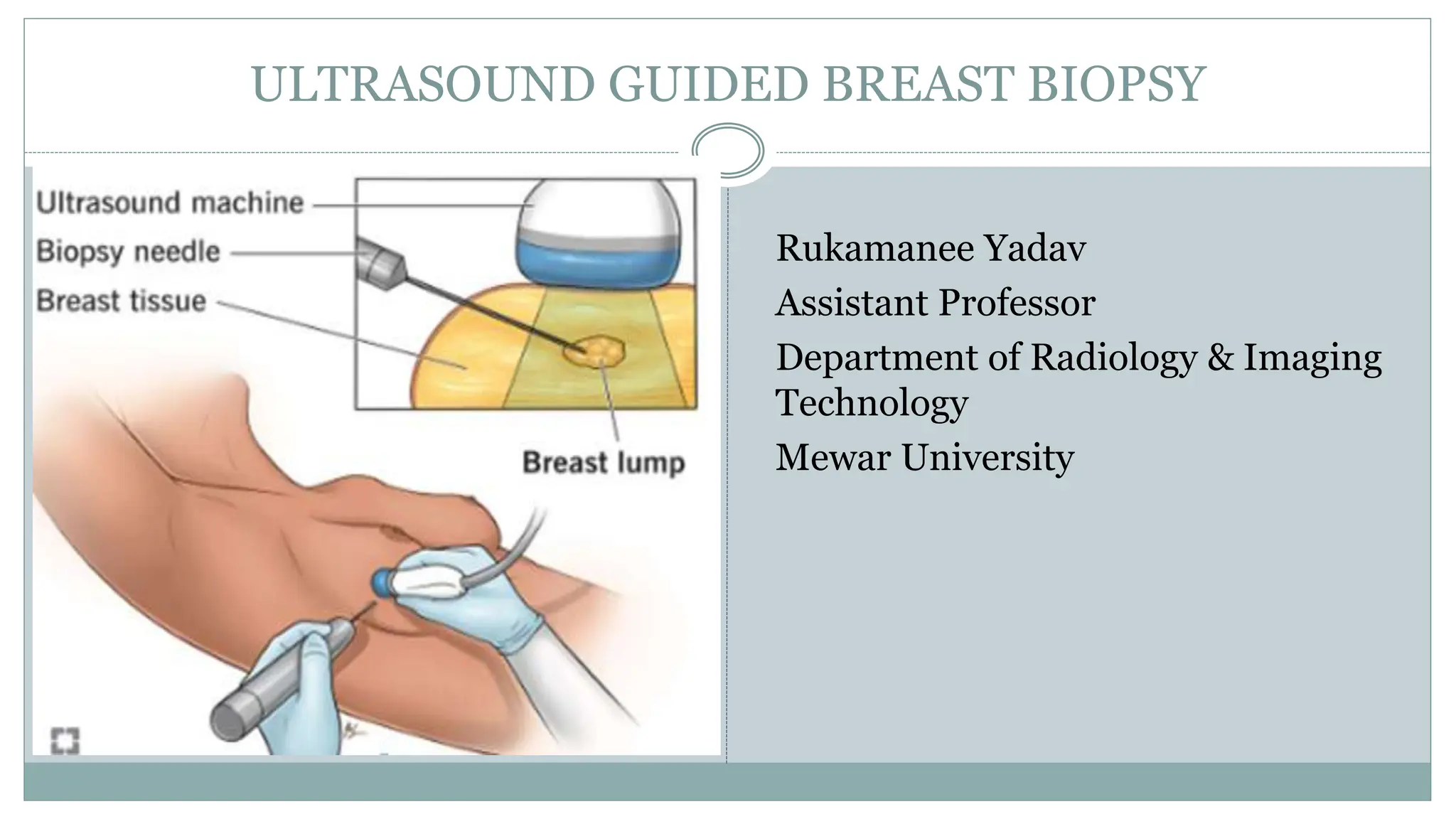 ULTRASOUND GUIDED BREAST BIOPSY.pptx,o know the nature of lesion. Cyst or lump formation | PPT