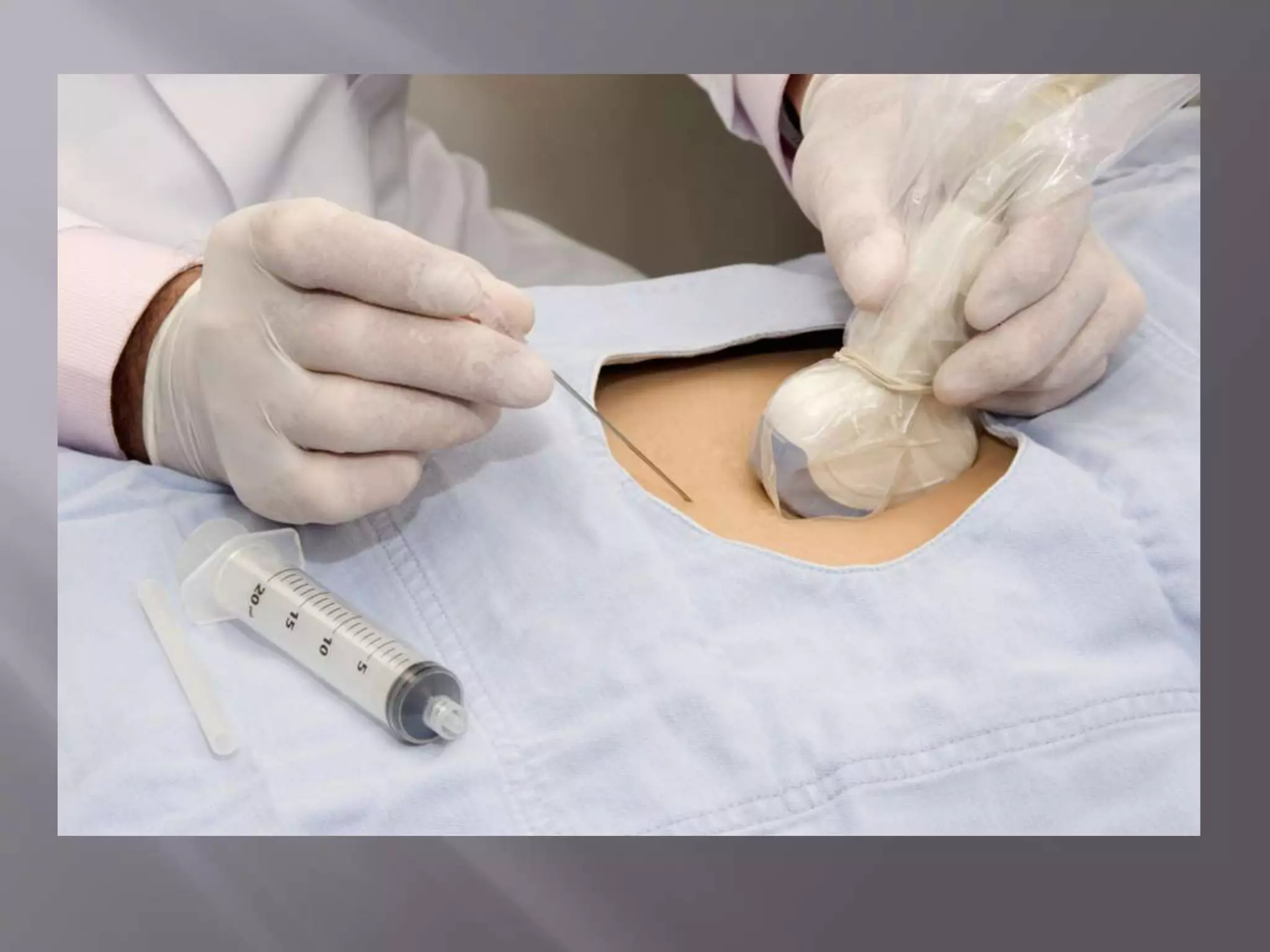 Ultrasound guided interventional procedure | PPTX