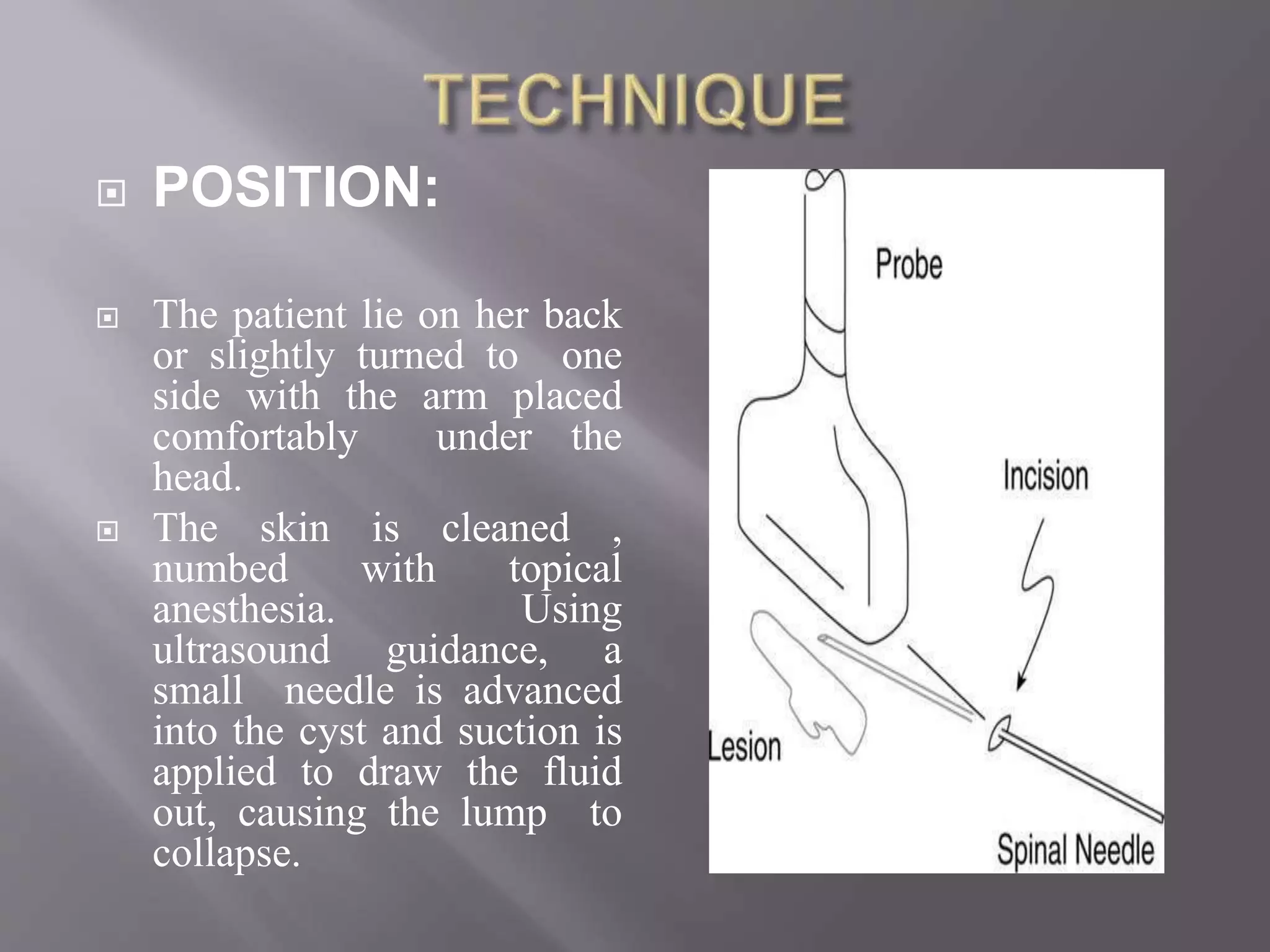 Ultrasound guided interventional procedure | PPTX