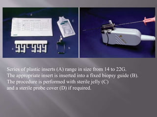 Ultrasound guided interventional procedure | PPTX