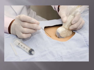 Ultrasound guided interventional procedure | PPTX