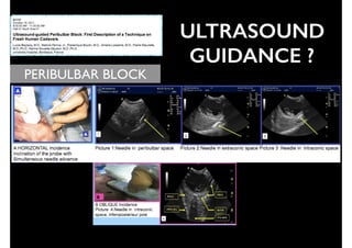 Ultrasound guided Ophtalmic block 2017 | PDF