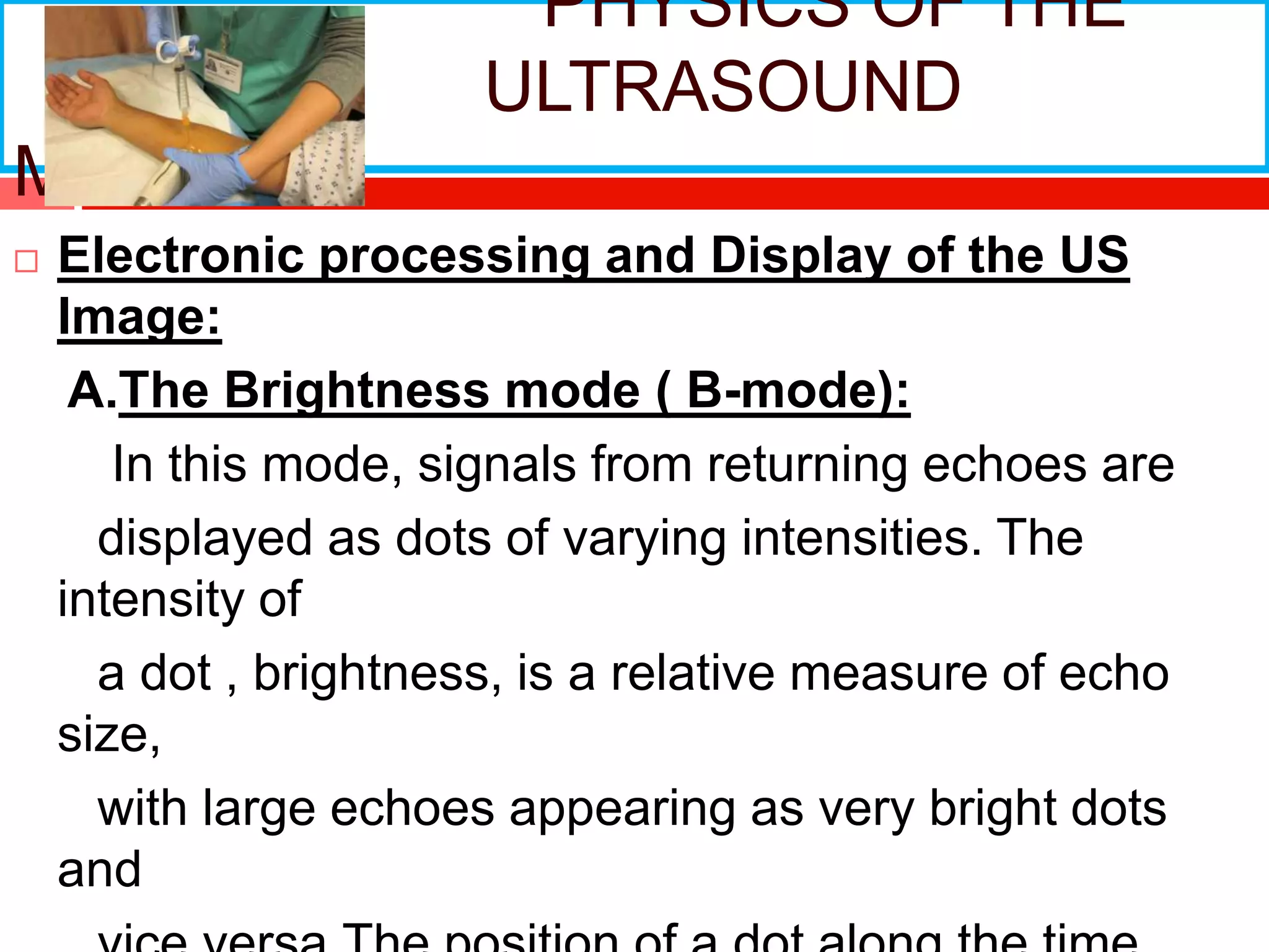 Ultrasound guided upper limb nerve block | PPTX