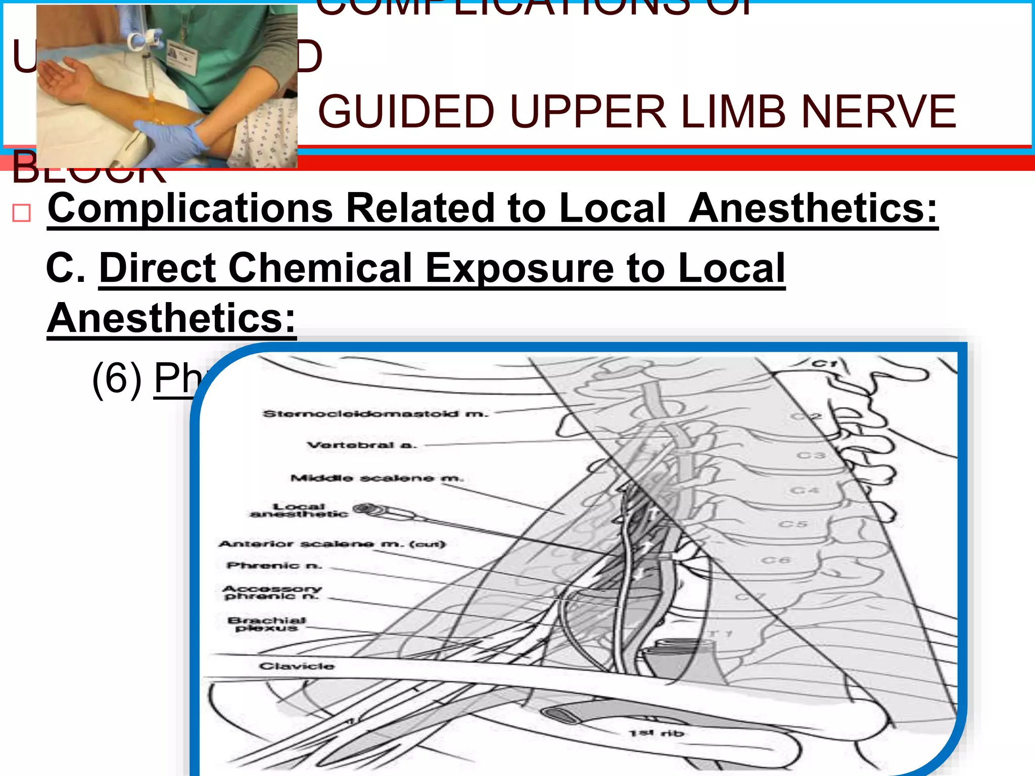 Ultrasound guided upper limb nerve block | PPTX