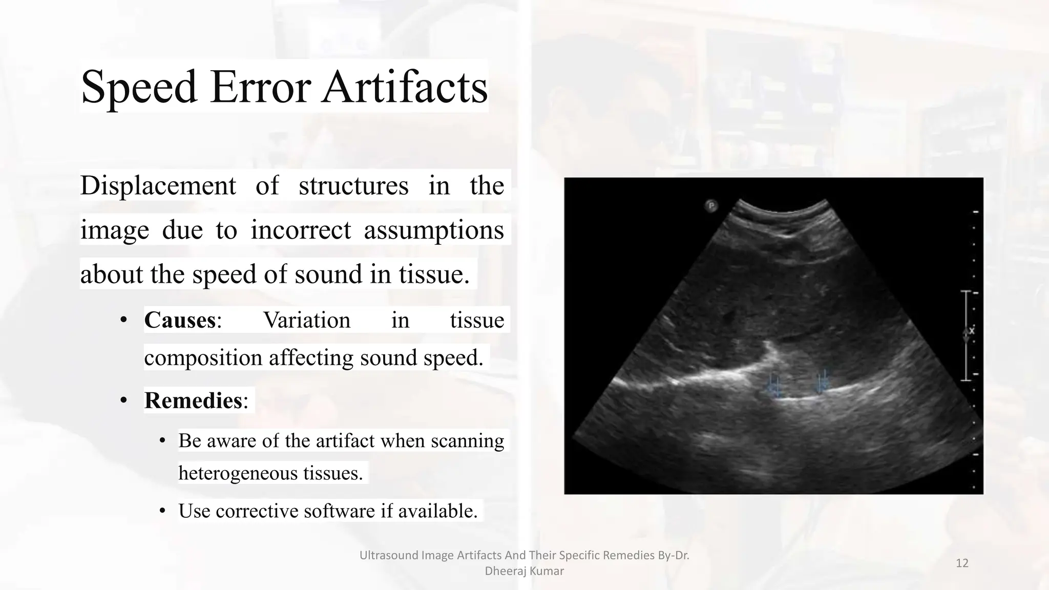 Ultrasound Image Artifacts and Their Remedies.pptx