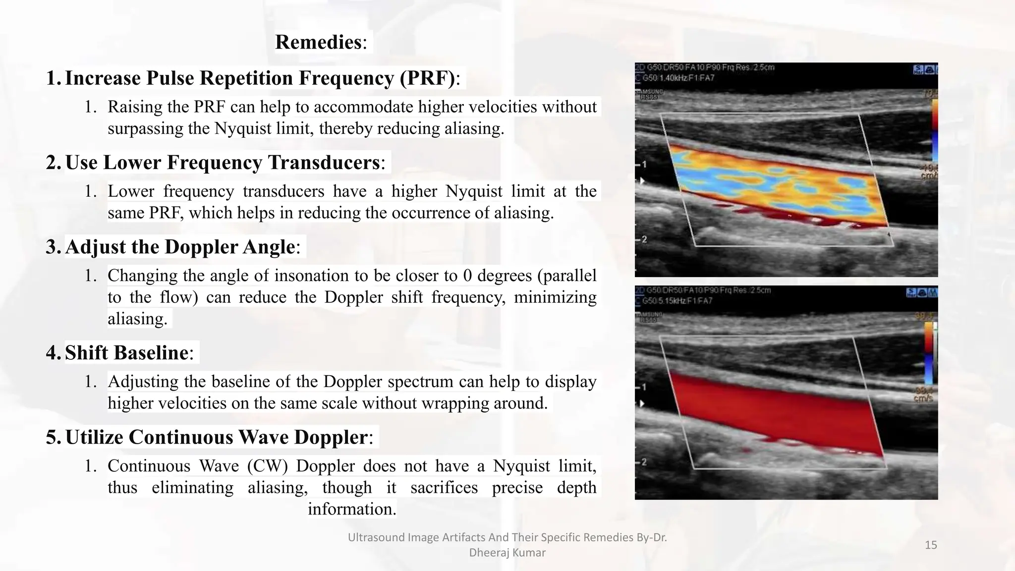 Ultrasound Image Artifacts and Their Remedies.pptx