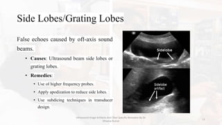 Ultrasound Image Artifacts and Their Remedies.pptx