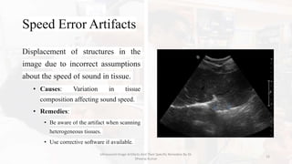 Ultrasound Image Artifacts and Their Remedies.pptx