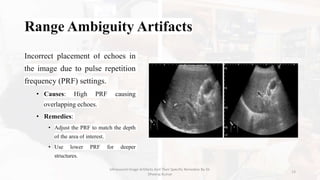 Ultrasound Image Artifacts and Their Remedies.pptx