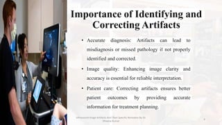 Ultrasound Image Artifacts and Their Remedies.pptx