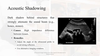 Ultrasound Image Artifacts and Their Remedies.pptx