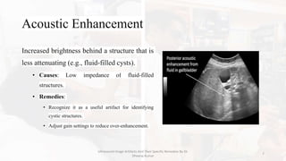 Ultrasound Image Artifacts and Their Remedies.pptx
