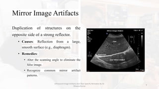 Ultrasound Image Artifacts and Their Remedies.pptx