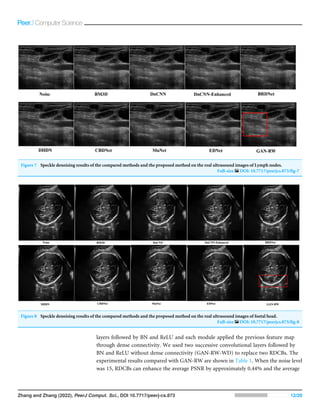 Ultrasound image denoising using generative adversarial networks with ...