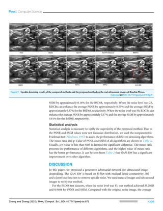 Ultrasound image denoising using generative adversarial networks with residual dense ...