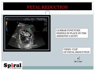 Ultrasound image gallery | PPTX