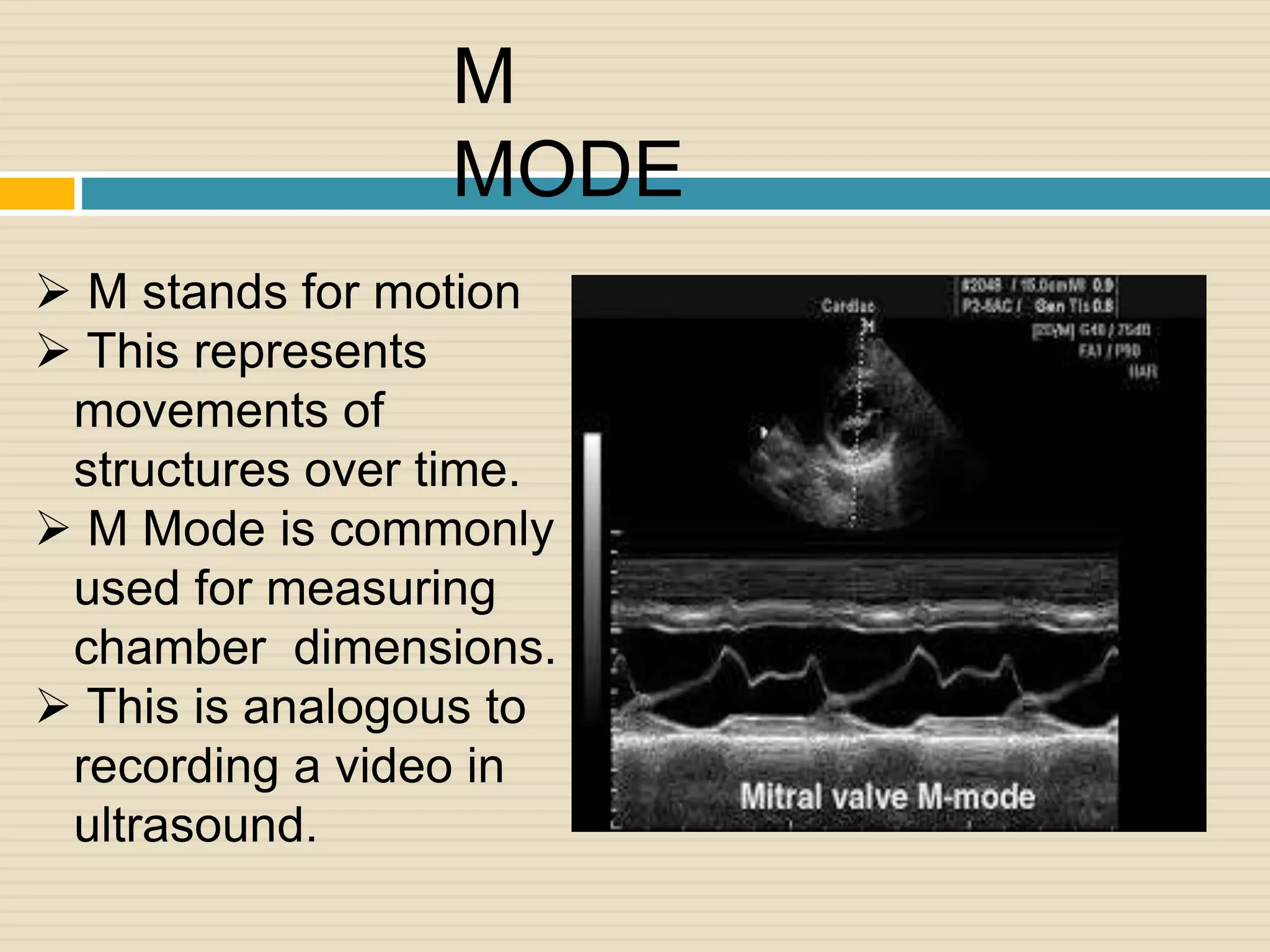 Ultrasound imaging | PPTX