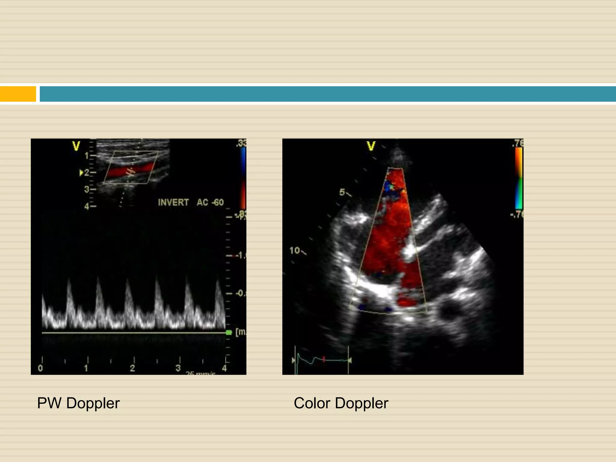 Ultrasound imaging | PPTX