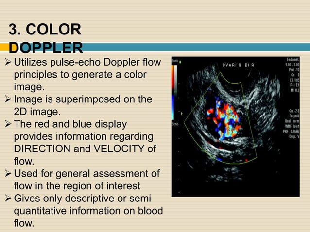 Ultrasound imaging | PPTX
