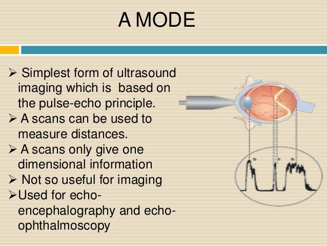 Ultrasound imaging