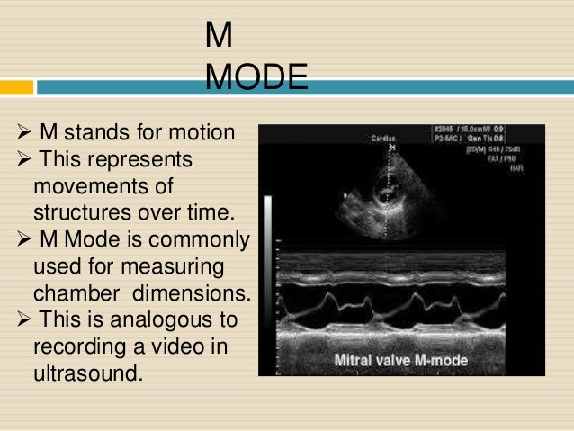 M Mode Ultrasound