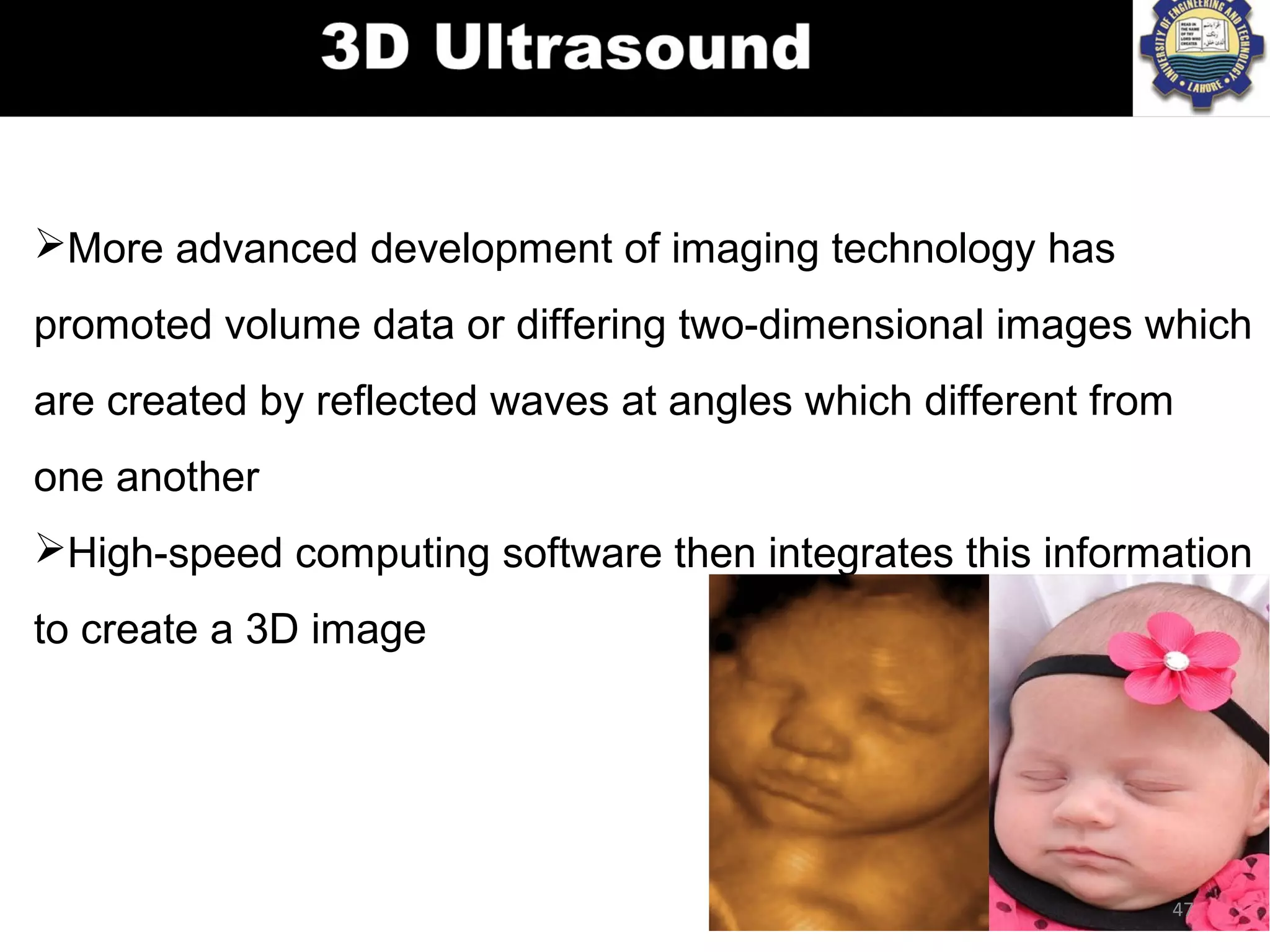 Ultrasound imaging | PPT