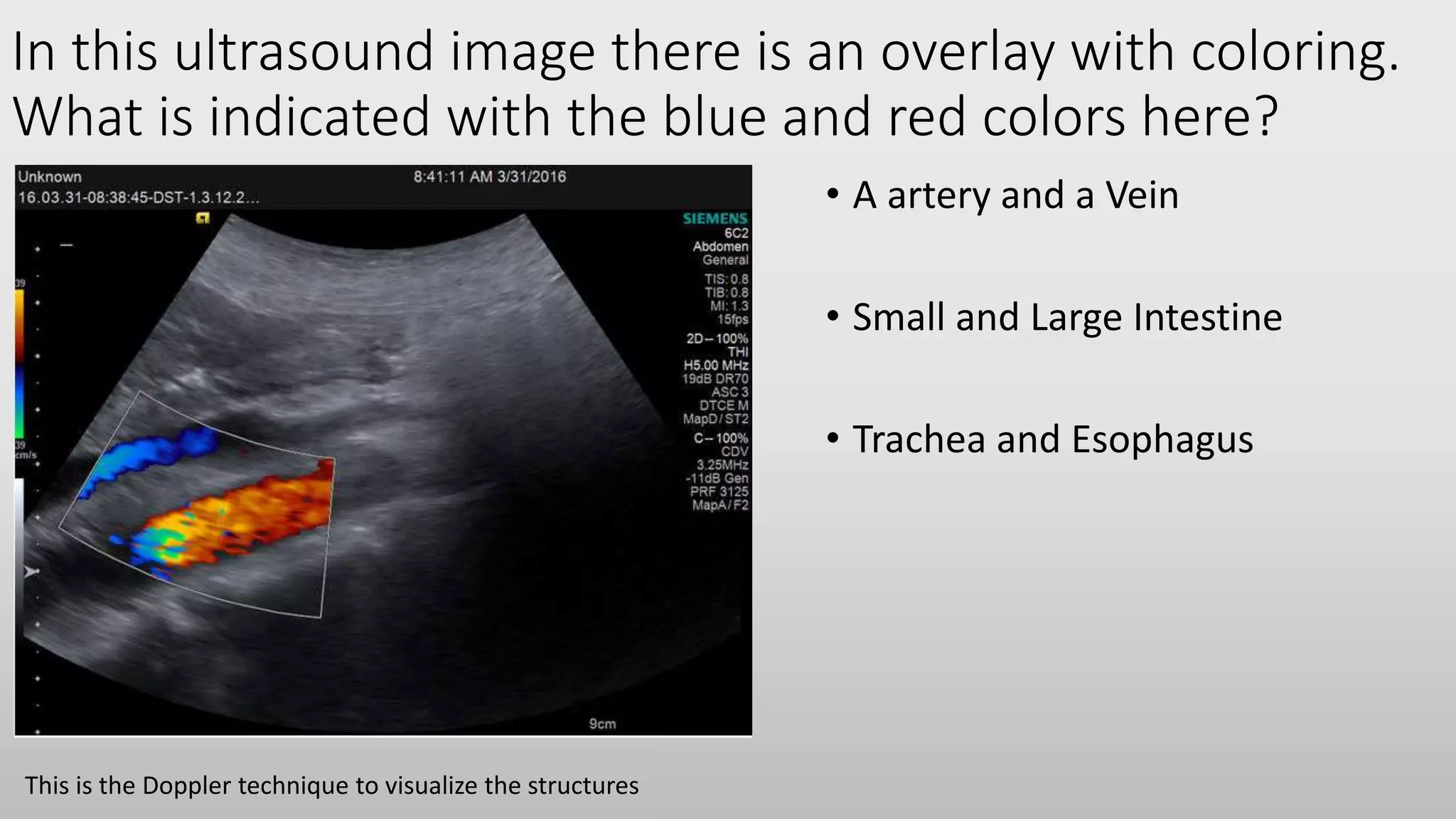 Ultrasound imaging | PPTX
