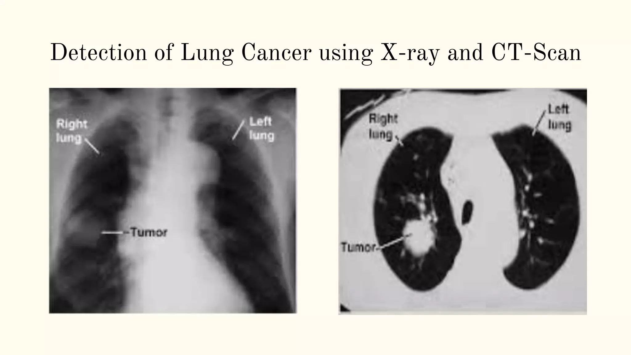 ULTRASOUND IMAGING.pptx