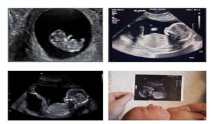 ULTRASOUND IMAGING.pptx