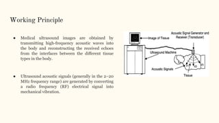 ULTRASOUND IMAGING.pptx