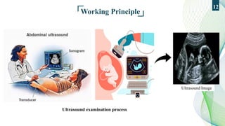 An Overview on Ultrasound Imaging Technique | PPTX