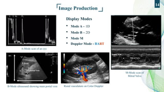 An Overview on Ultrasound Imaging Technique | PPTX