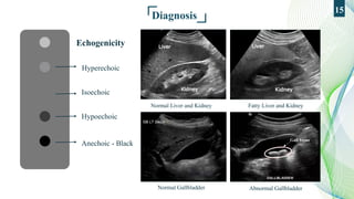An Overview on Ultrasound Imaging Technique | PPTX