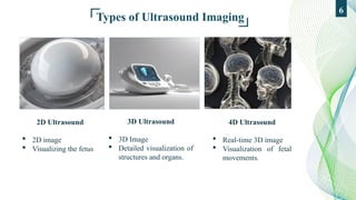 An Overview on Ultrasound Imaging Technique | PPTX