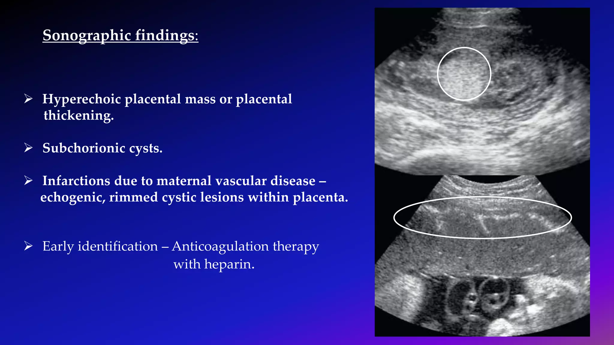 Ultrasound Imaging of Placenta | PPTX
