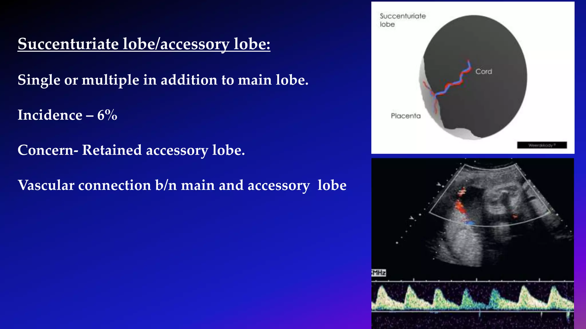 Ultrasound Imaging of Placenta | PPTX