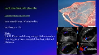 Ultrasound Imaging of Placenta | PPTX