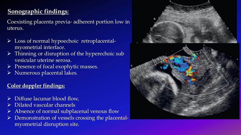 Ultrasound Imaging of Placenta