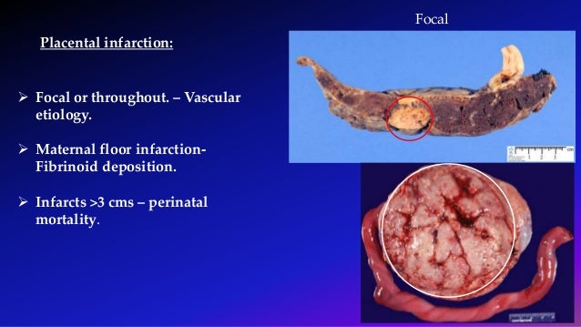 Ultrasound Imaging of Placenta