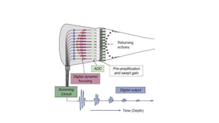Ultrasound imaging system | PPTX