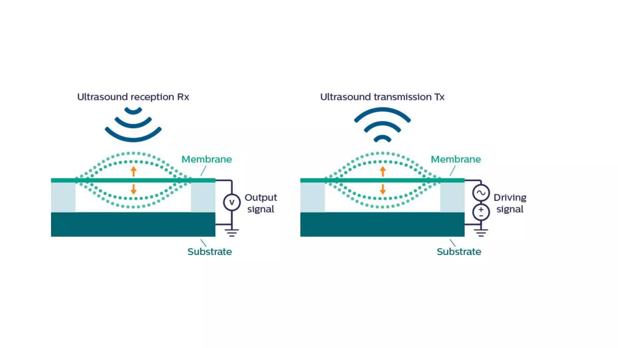 Ultrasound imaging system | PPTX
