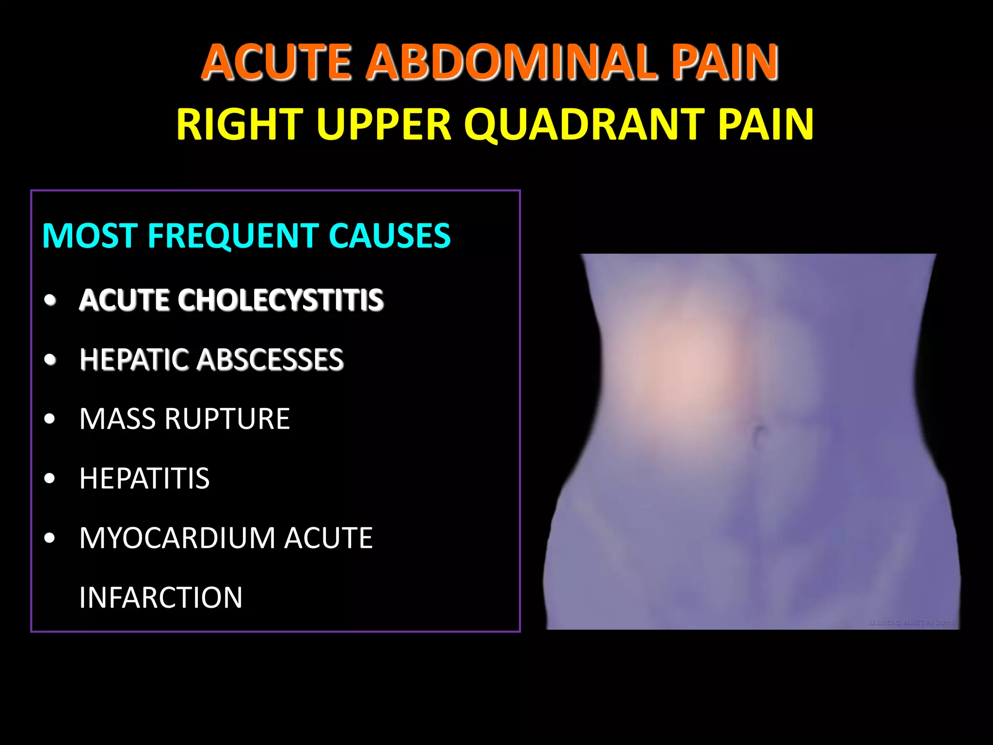 Ultrasound in acute abdominal pain | PDF