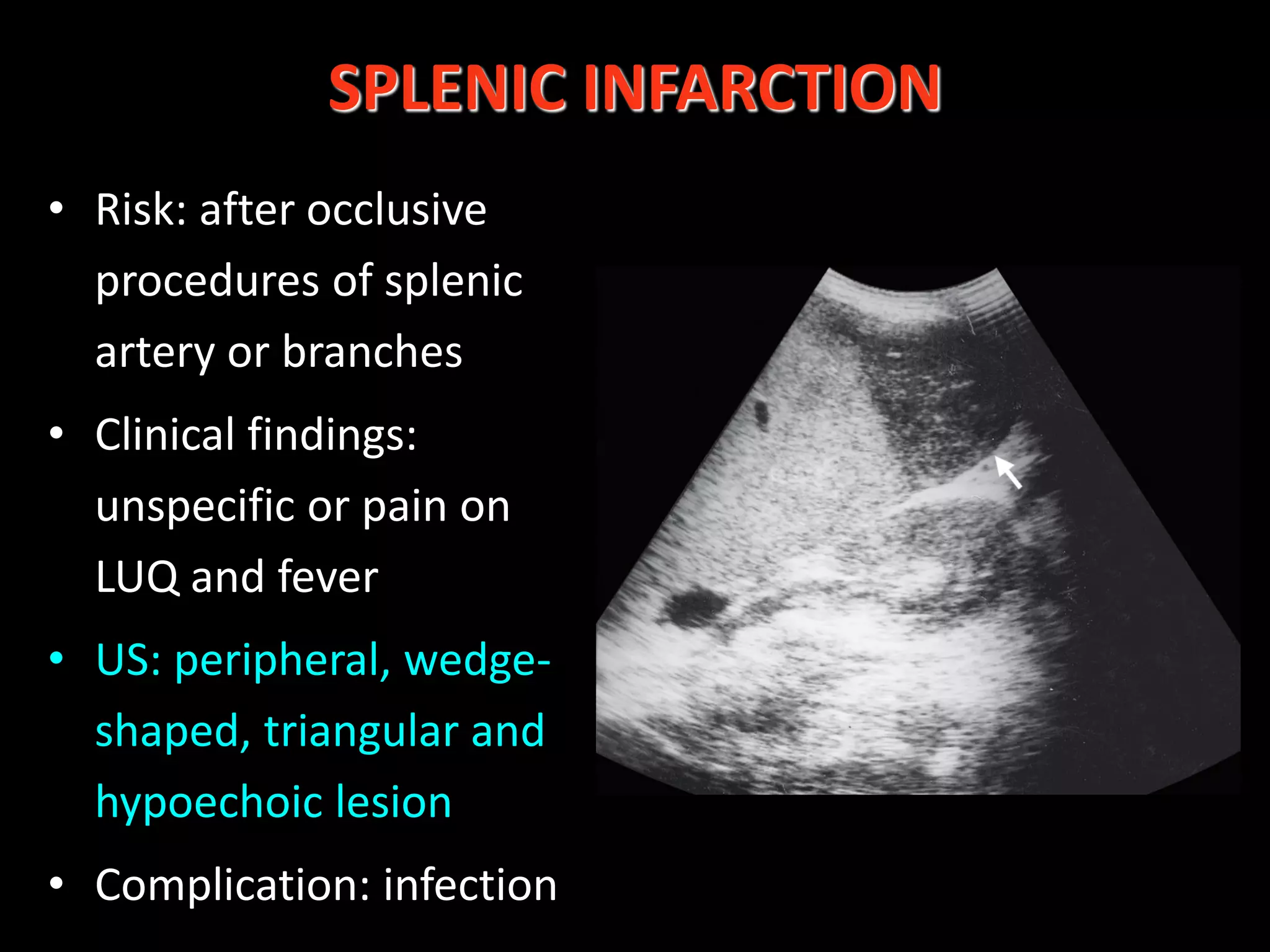 Ultrasound in acute abdominal pain | PDF