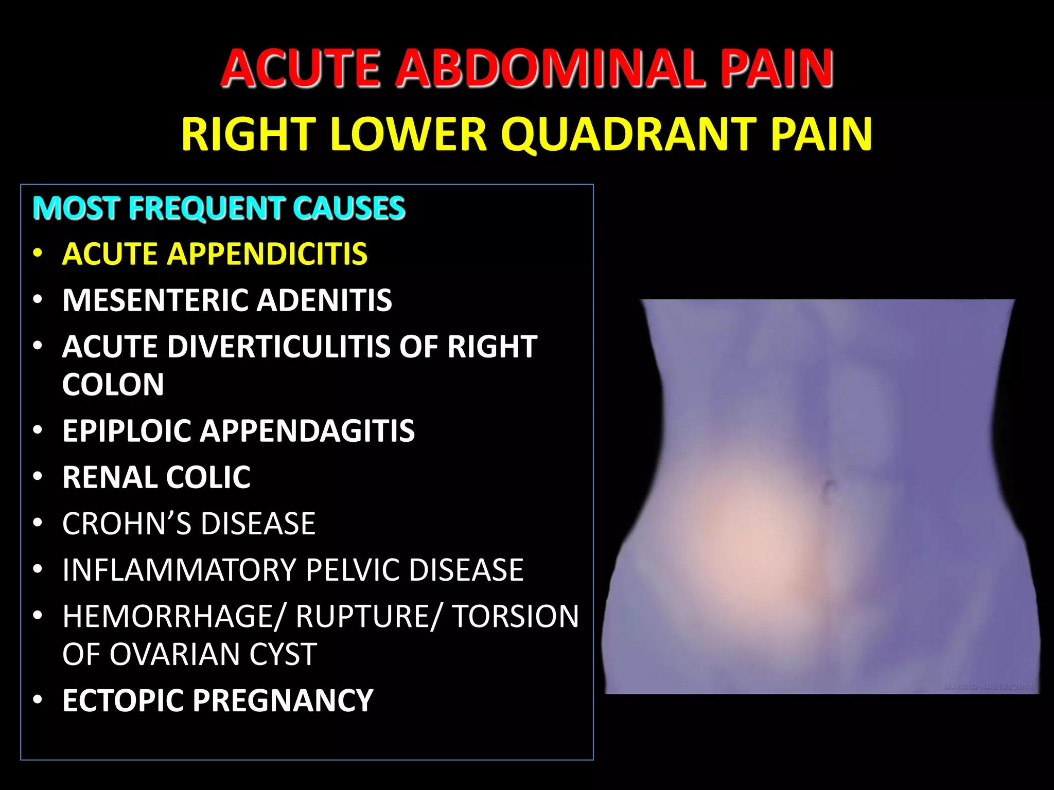 Ultrasound in acute abdominal pain | PDF