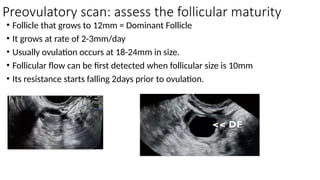 ULTRASOUND IN ART(Marvin). Master class series | PPTX